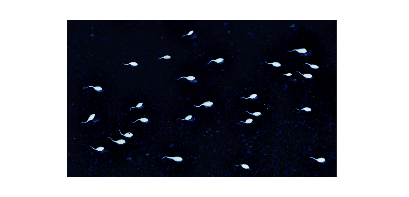 Seminograma: Análisis del semen - Segrelles IVF